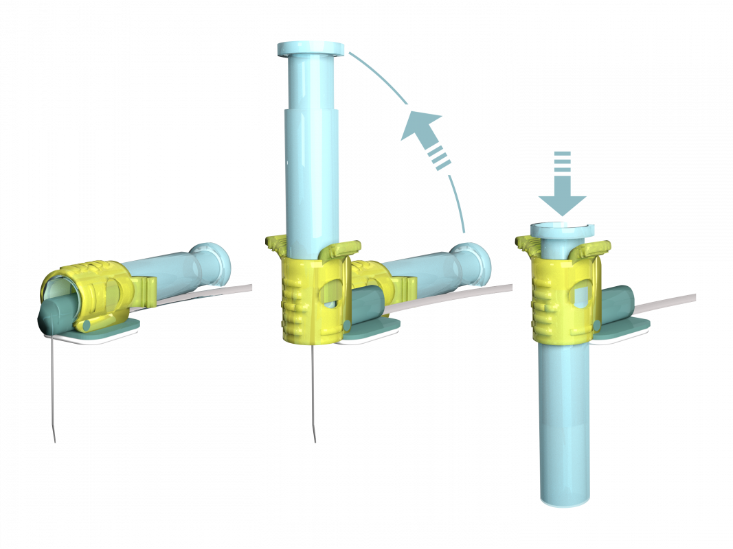 Punctur-Guard™ Positive Pressure Safety huber needle CT Rated | Nipro ...